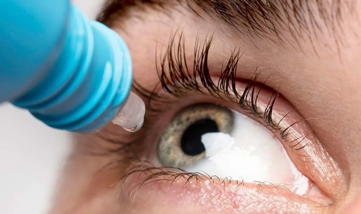 MGD and Dry eye - BVECC